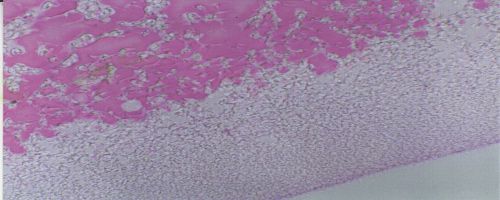 Medical (Healthcare) Filtration | Pall Corporation